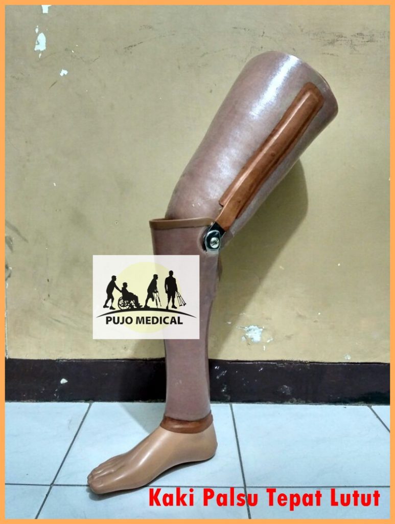 Kaki Palsu Pemalang - PujoMedical.Com